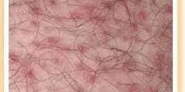 Folliculitis Treatment - Advanced Dermatology Specialists